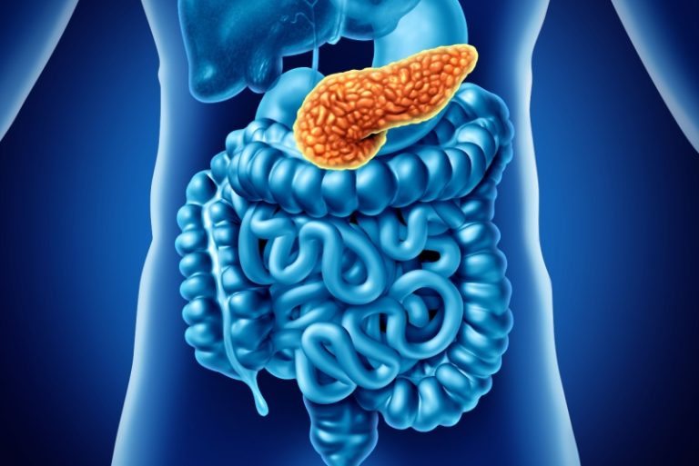 Pancreatite: o que é, quais os sintomas e como tratar